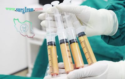 What You need to know about Fat Transfer - SurgIran Group-